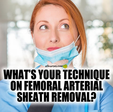 Techniques on Femoral Arterial Sheath removal? - CCU, Coronary, Cardiac