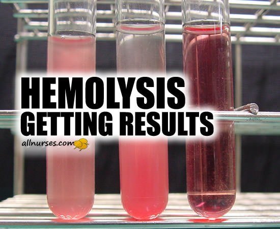 Hemolyzed Tubes - scientific question - General Nursing Support