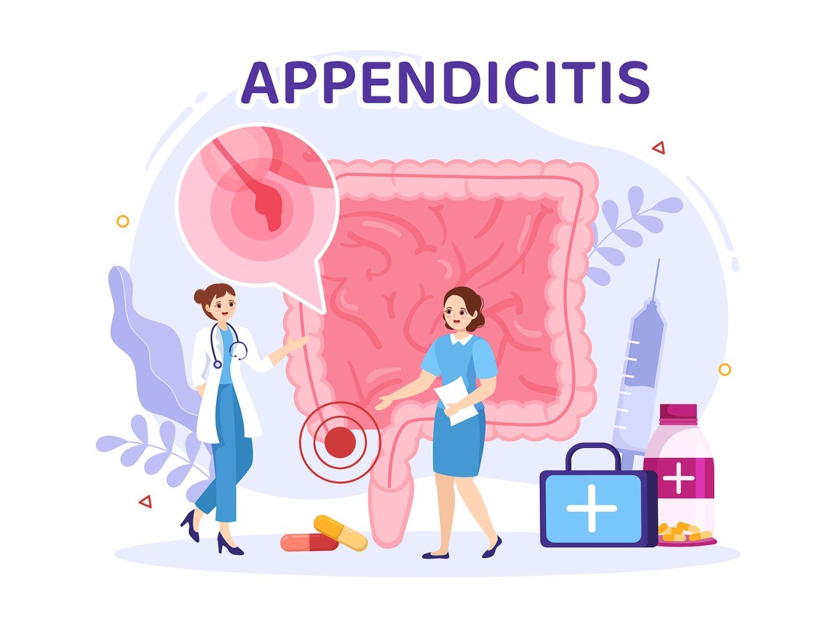 Appendicitis | Nursing Diagnosis, Care Plan, and More - General Nursing ...